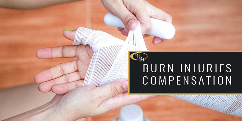 Burn Injuries: How You Could Get Compensated - Personal Injury Attorney